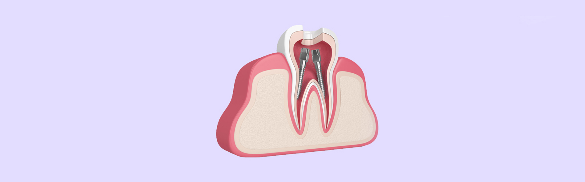The Importance of Endodontics in Saving Natural Teeth | Blog